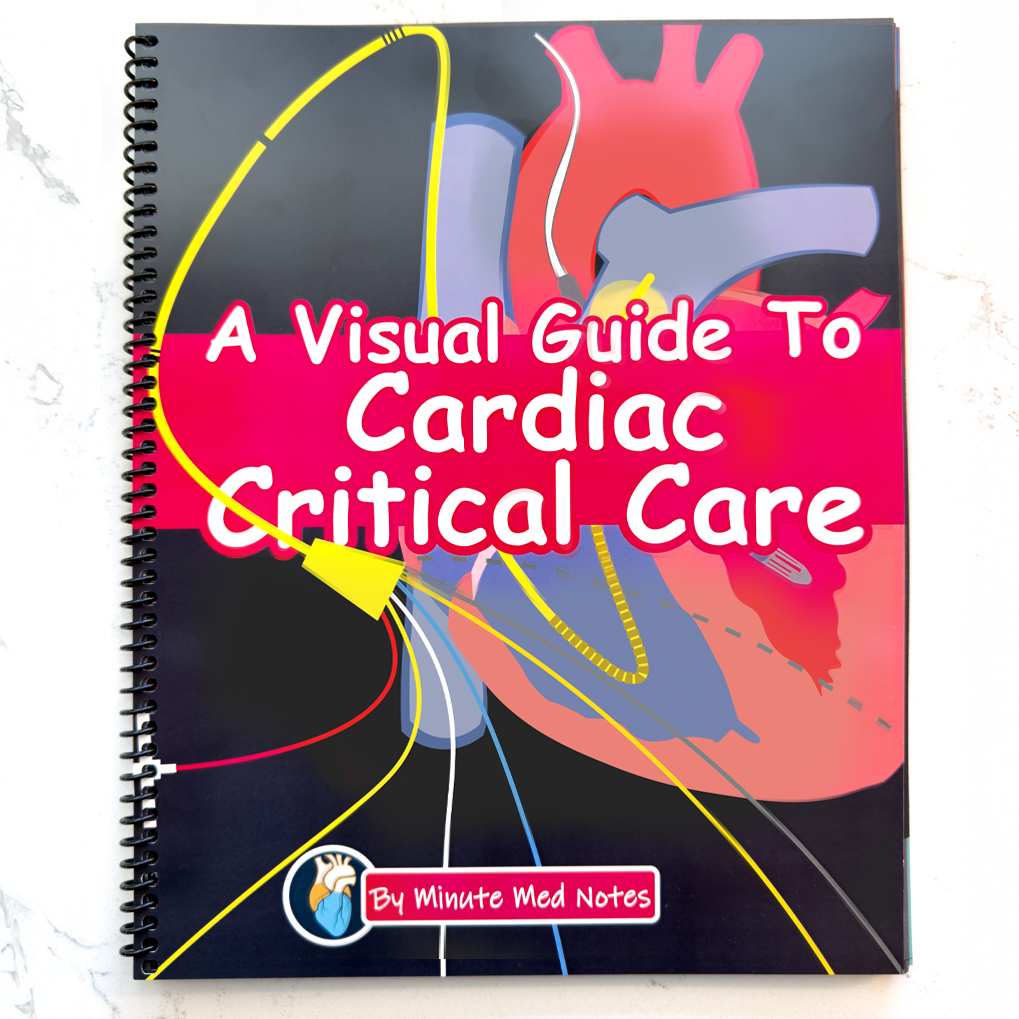 A Visual Guide to Cardiac Critical Care – Minute Med Notes